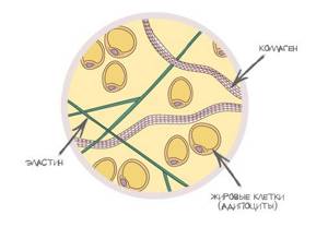 What is cellulite and does it hurt? Does cellulite hurt? There are four ...
